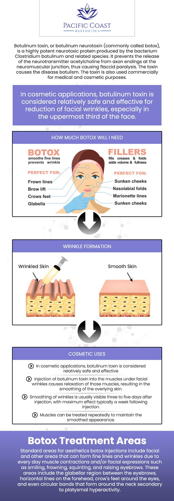 What Should I Expect from Botox Treatment?